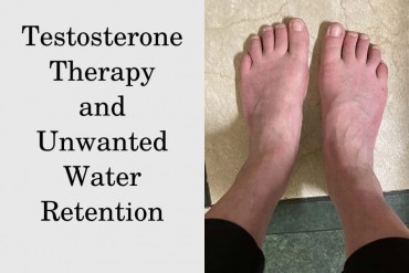 Water Retention from TRT | Does Every Patient Suffer? | HRTGuru Clinic