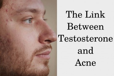Is Testosterone a Cause of Your Acne? - HRTGuru